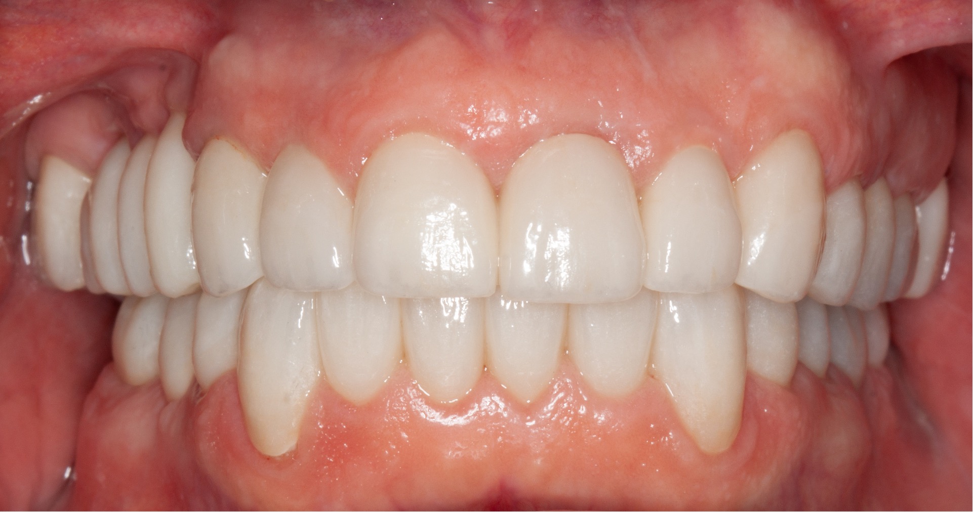 Smile Gallery Plymouth MI, Michigan Prosthetic Dentistry